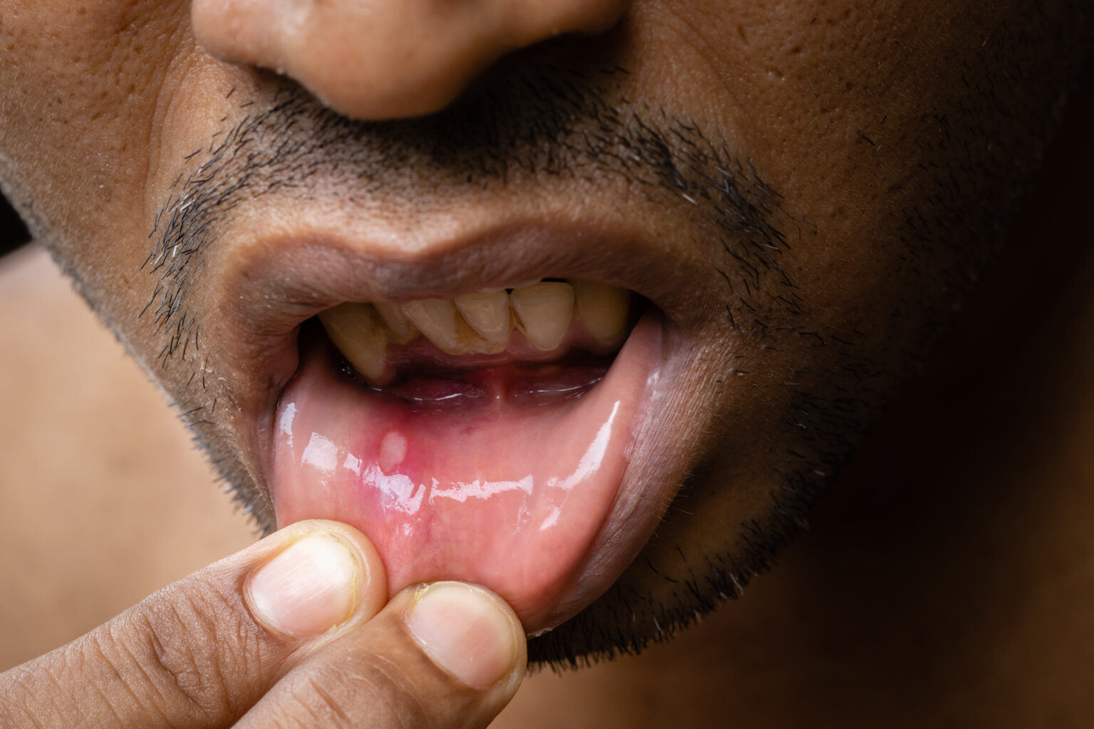 Oral Cancer Screen – Kennedy Dental and Orthodontics – Brampton Dental ...